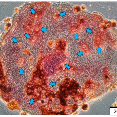 Mature Multi Nucleated Osteoclast In Vitro Pictured Is One Mature