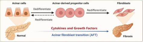 腺泡细胞与胰腺纤维化的发展cytokine And Growth Factor Reviews X Mol
