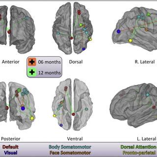 75 Consensus Features Shared Across Risk Group Specific SVMs Lines Download Scientific