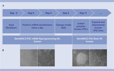 Reprogramming Of Human Fibroblasts Into Induced Pluripotent Stem Cells