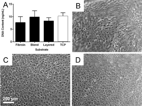 Retinal Pigment Epithelial Rpe Cell Behaviour On Biomaterial