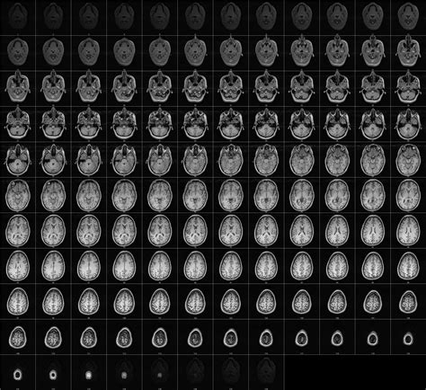 Brainmapsorg Brain Atlas Brain Maps Brain Structure