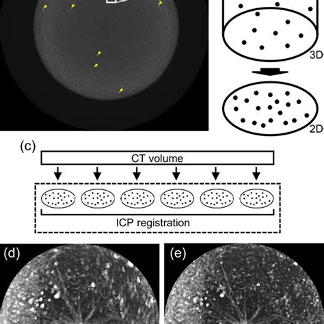 Sbi Icp Registration A A Xy Slice Of An X Ray Ct Image Image Size Is Download Scientific
