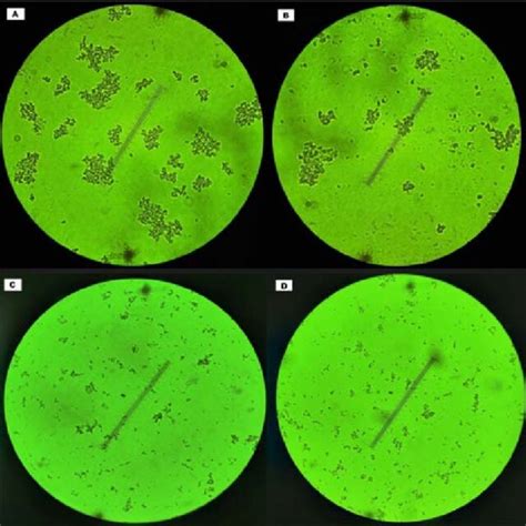 Caox Crystals As Seen Under Microscope At Different Treatment Download Scientific Diagram