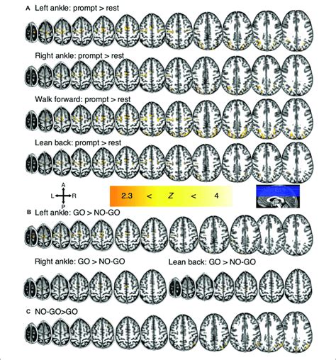 Regions Of Significant Group Level Bold Activation For A Motor Download Scientific Diagram