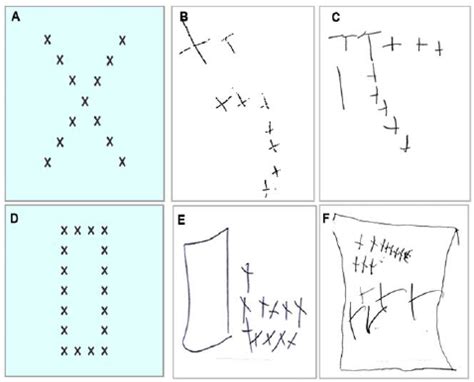 Differences Between WBS Patient Subgroups On Spatial Construction Download Scientific Diagram