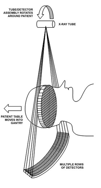 Conventional Computed Tomography − Fan Shaped X Ray Beam Rotates Around Download Scientific