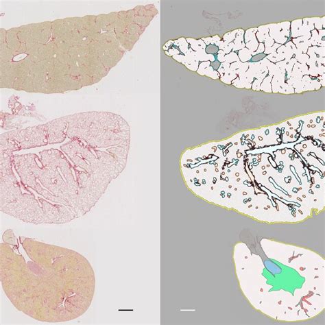Computer Assisted Segmentation Of Histological Structures In The Three