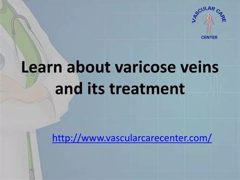 Ppt Varicose Veins Treatment In Hyderabad Vascular Care Center