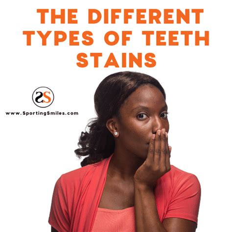 The Different Types Of Teeth Stains Sportingsmiles Dental