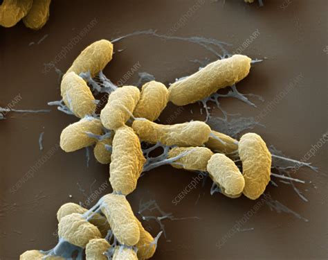Plague Bacteria Yersinia Pestis SEM Stock Image C009 0894