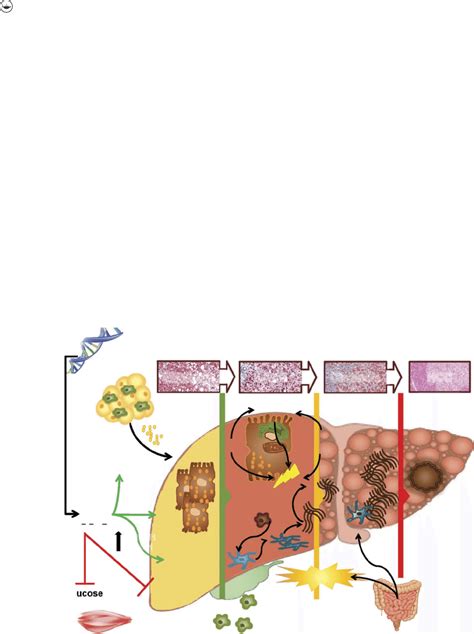 The Role Of Insulin Resistance In Nonalcoholic Steatohepatitis And