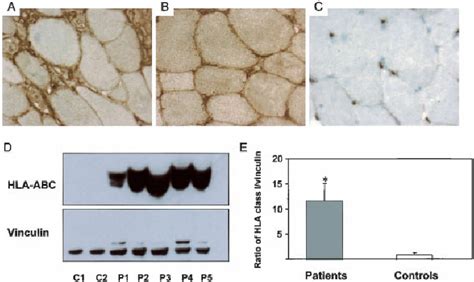 Overexpression Of Class I Major Histocompatibility Complex Mhc Download Scientific Diagram
