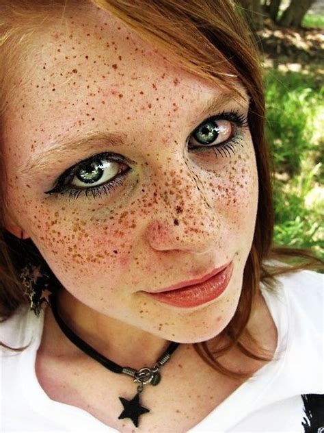 Redheads With Tons Of Freckles Porn Fan Community Forum