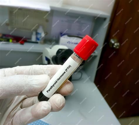 Premium Photo Scientist Or Biochemist Hold A Sample For Parathyroid Hormone Or Pth Test