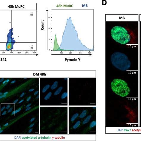 Human Murc Are Transcriptionally Less Active And Possess A Primary Download Scientific Diagram