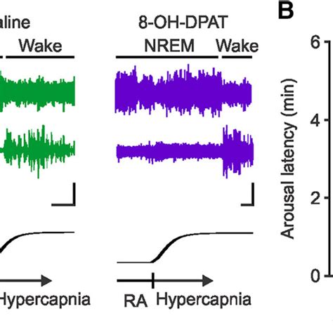 Inactivation Of 5 Ht Neurons Through Systemic Application Of 8 Oh Dpat
