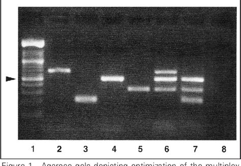 Figure 1 From Use Of A Multiplex Polymerase Chain Reaction Assay In The