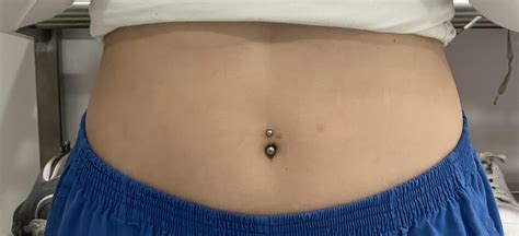 Crooked Belly Button Rpiercing