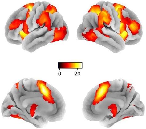 Fmri Based Modelling Gives Insight Into How Our Minds Control Impulses Applied Radiology