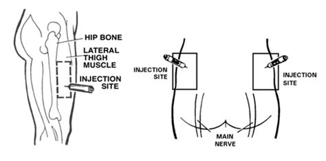 Nerve Agent Treatment Autoinjector Instructions CHEMM