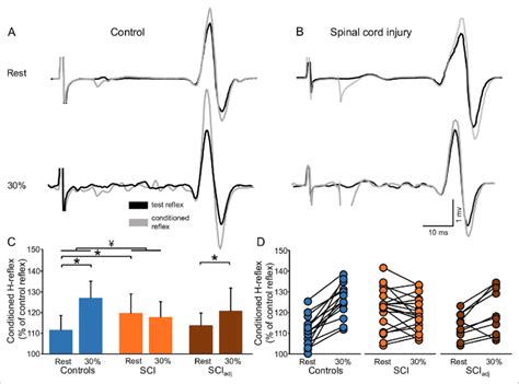 Fn Facilitation Representative Traces Showing The H Reflex Control Download Scientific