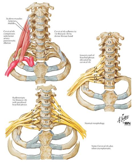 Your Cervical Ribs Are Probably Non Existent Sauropod Vertebra