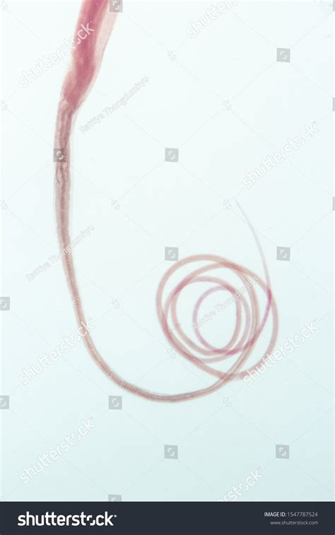 Trichuris Trichiura Under Microscope Foto Stock 1547787524 Shutterstock
