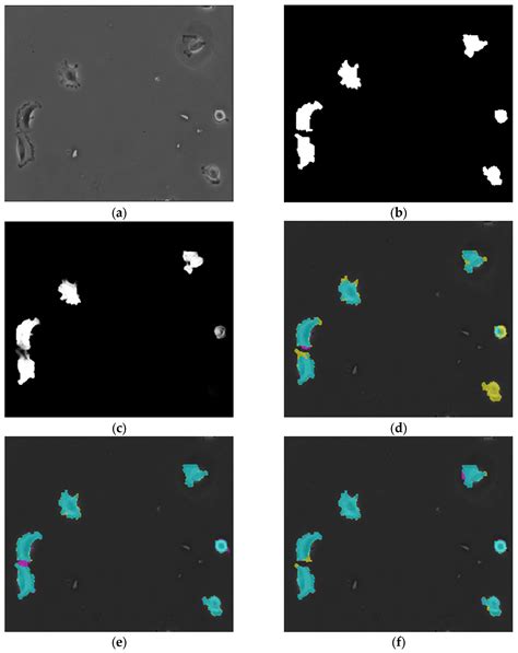 Aid U Net An Innovative Deep Convolutional Architecture For Semantic