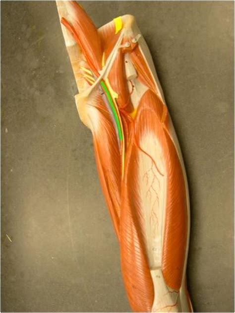 Femoral Artery Bleeding