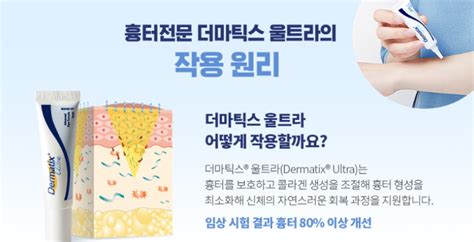 약국에서 살 수 있는 흉터연고 종류 사용연령 효과 사용법 주의사항 더마틱스울트라 시카케어 콘트라투벡스 노스카나