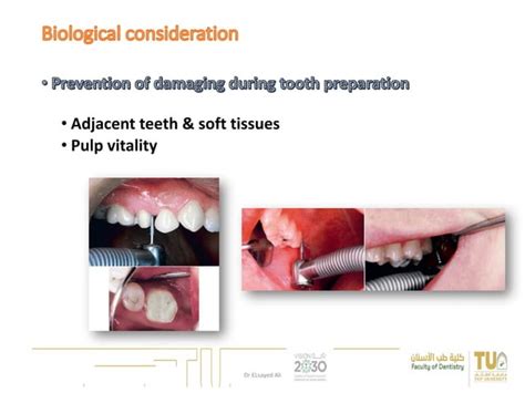 Principles Of Tooth Prep Ppt 20 21taifpdf