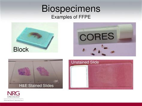 Biospecimen Collection Nrg Oncology Biospecimen Banks Ppt Download