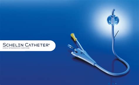 Schelin Catheter® Minimally Invasive Surgical Catheters