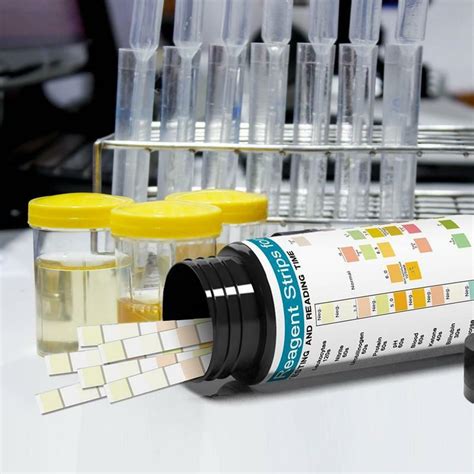100 Strips Urs 9 Urinalysis Reagent Strips Urine Test Strip Leukocytes