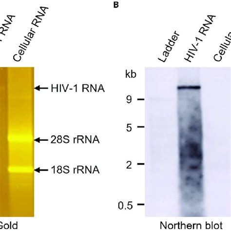 visualization of full length hiv 1 genomic rna a hiv 1 rna purified