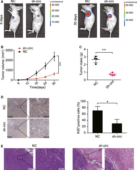 Silencing Circ0128846 Inhibited The Tumorigenesis Of Crc Cells In