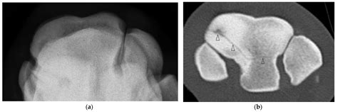 Comparison Of Radiography And Computed Tomography For Evaluation Of Third Carpal Bone Fractures