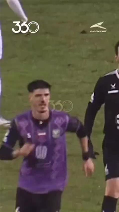 راه عجیب کادر پزشکی خیبر خرم‌آباد برای قطع خونریزی صورت مبین دهقان جعبه