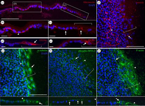 The Expression Of Markers Of Cell To Ecm Adhesion Fibronectin Itga6