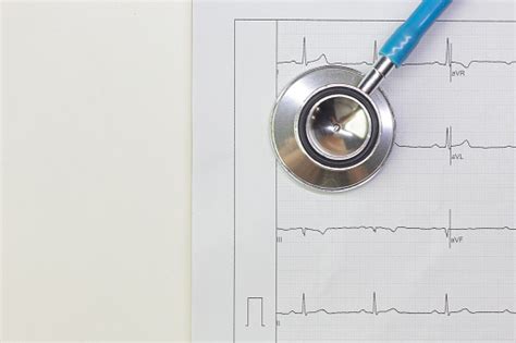 블루 청진 기와 및 심전도 차트 이미지를 닫습니다 건강 검진에 대한 스톡 사진 및 기타 이미지 건강 검진 건강 진단 건강