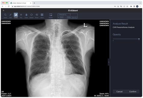 Promedius Inc Brings Cutting Edge Medical Imaging Ai Cloud Platform