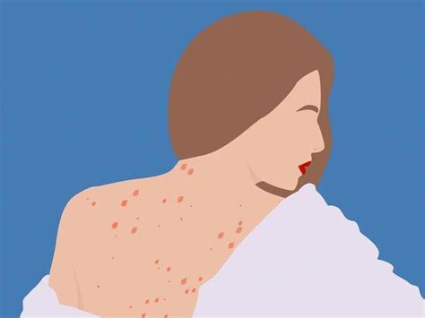 Do You Have These Red Spots On Various Parts Of Your Body Red
