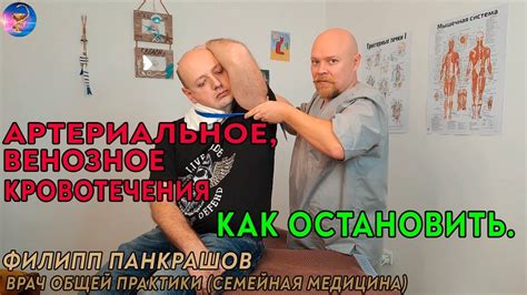 Артериальное венозное кровотечение как остановить Остановка