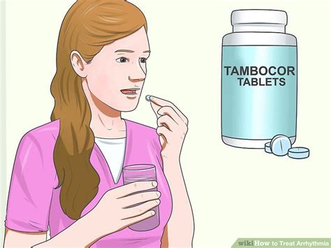 How To Treat Arrhythmia With Pictures WikiHow Health
