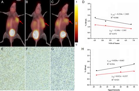 The Correlation Between 99m Tc Hynic Fapi 04 Spect And Tumor