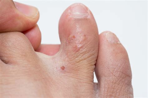 What Causes Hard Red Itchy Bumps On Skin Printable Templates Protal