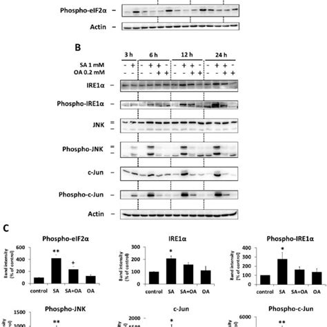 P53 Promotes Apoptosis And Inhibits Autophagy Nuclear P53 Induces