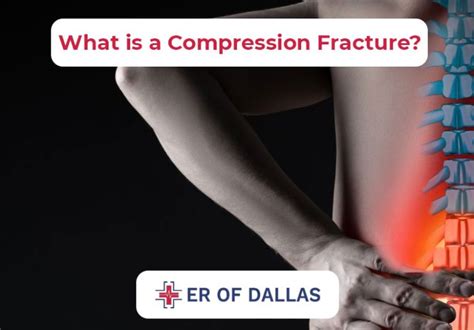 Compression Fractures Causes Symptoms Treatment And Prevention Er Of