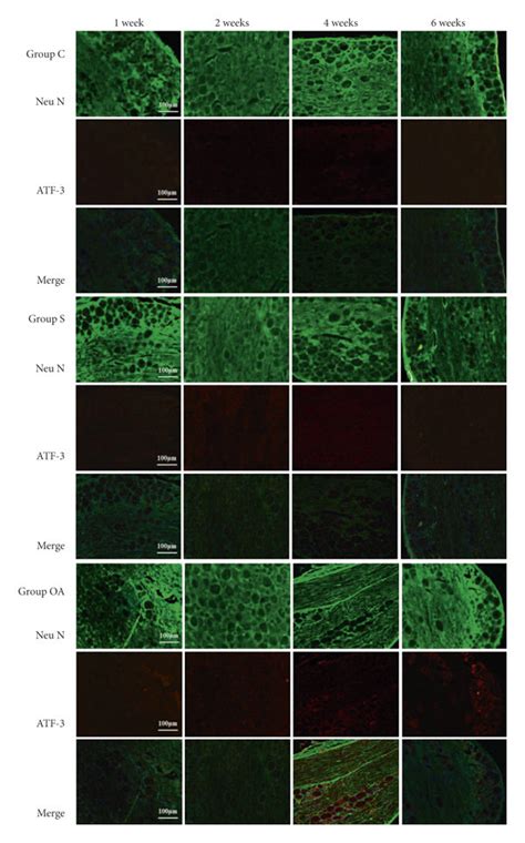 Comparison Of Atf 3 Expression In The Three Groups Of Rats At Each Time